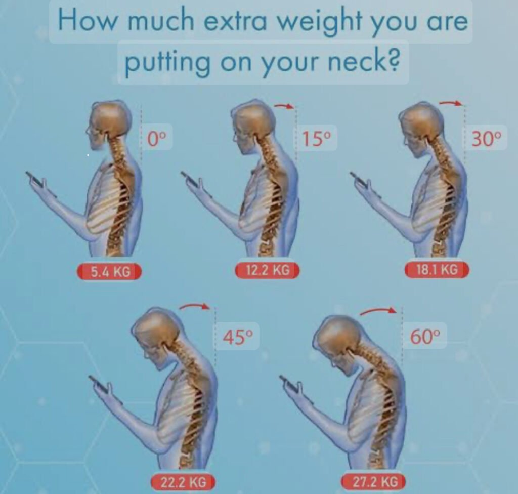 The Impact Of Phone Addiction On Cervical Spine And Its Physiotherapy ...